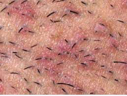 Skin Conditions - The Beauty Training School